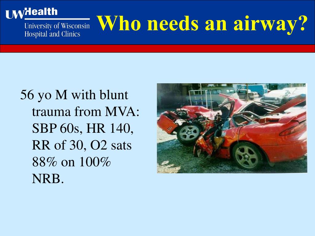 PPT - Airway Management in Trauma Trauma Conference UW Hospital and ...