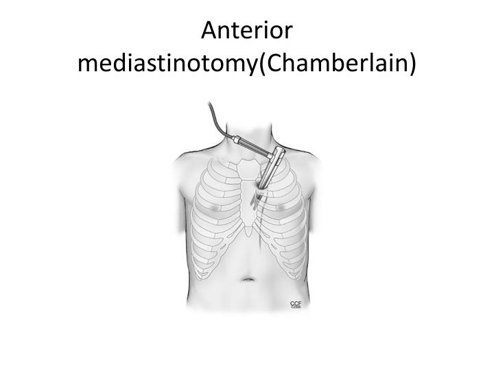 PPT - THORACIC INCISIONS PowerPoint Presentation - ID:391276