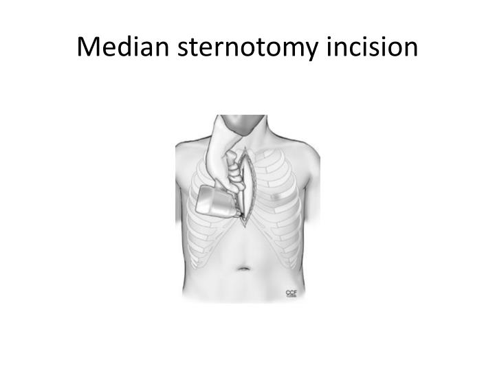 PPT - THORACIC INCISIONS PowerPoint Presentation - ID:391276