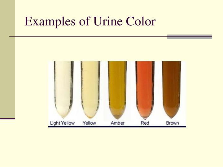 PPT - Examination of Urine PowerPoint Presentation - ID:391453