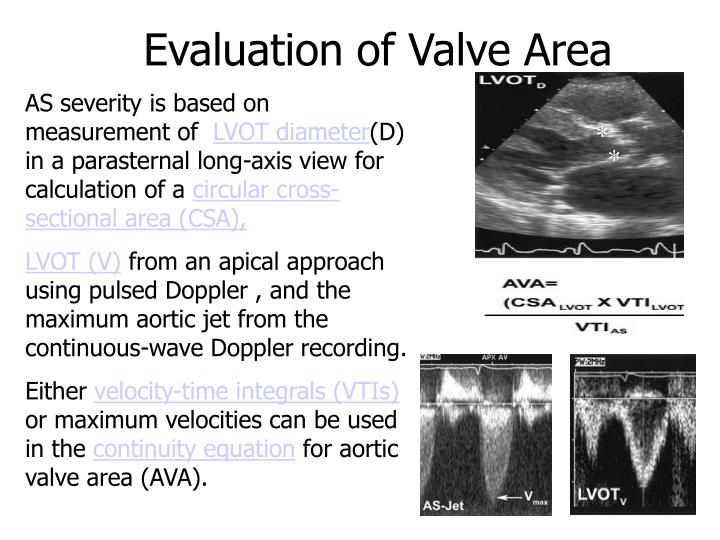 PPT - Aortic Valve Disease PowerPoint Presentation - ID:391667