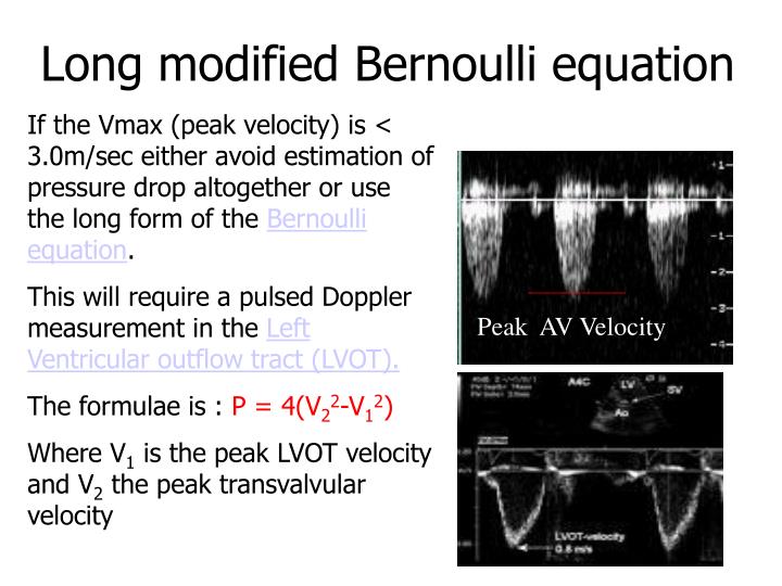PPT - Aortic Valve Disease PowerPoint Presentation - ID:391667