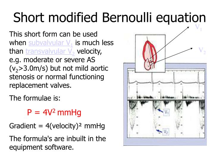 PPT - Aortic Valve Disease PowerPoint Presentation - ID:391667