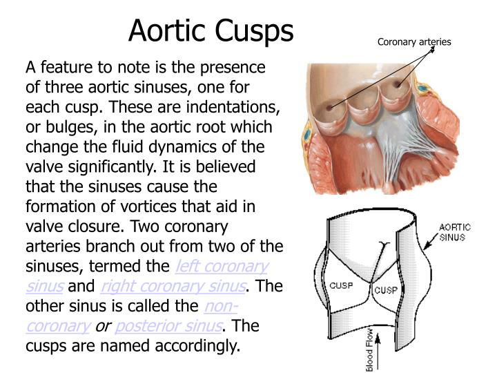 PPT - Aortic Valve Disease PowerPoint Presentation - ID:391667