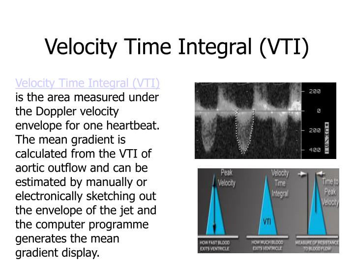 PPT - Aortic Valve Disease PowerPoint Presentation - ID:391667