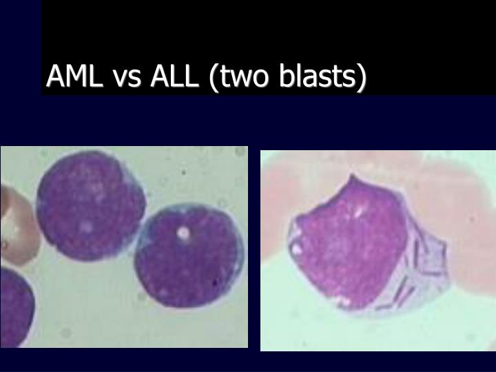 PPT - Review: Hematology PowerPoint Presentation - ID:393674