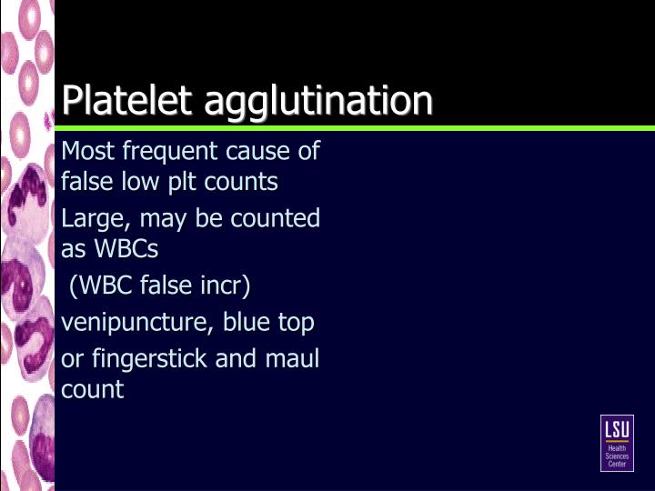 PPT - Review: Hematology PowerPoint Presentation - ID:393674