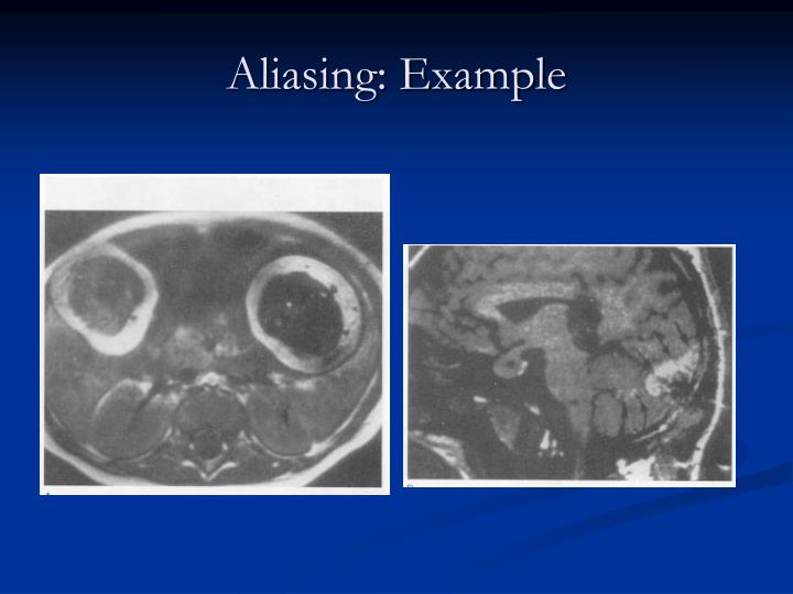 PPT - Basic MRI PowerPoint Presentation - ID:394624