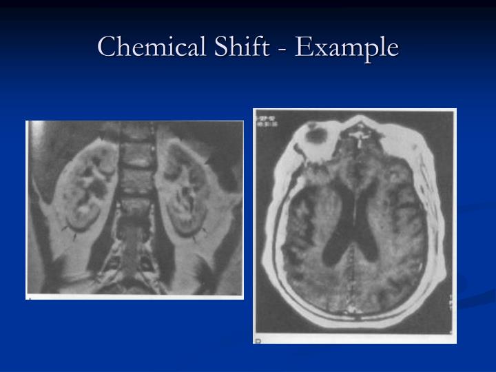 PPT - Basic MRI PowerPoint Presentation - ID:394624