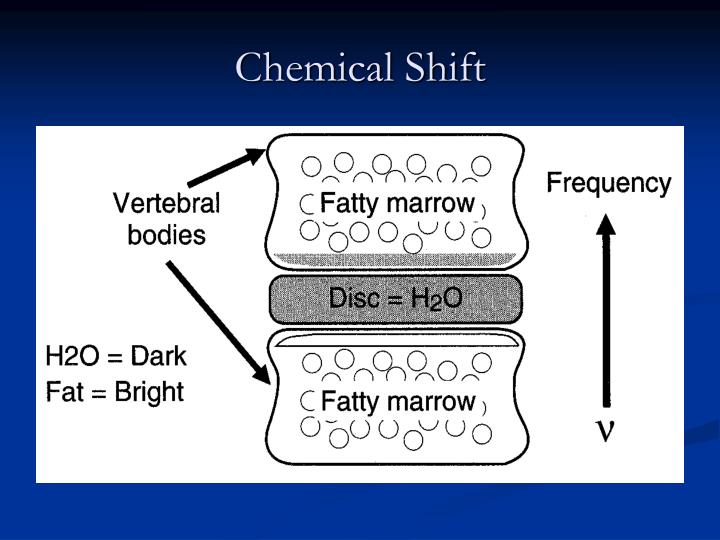 PPT - Basic MRI PowerPoint Presentation - ID:394624