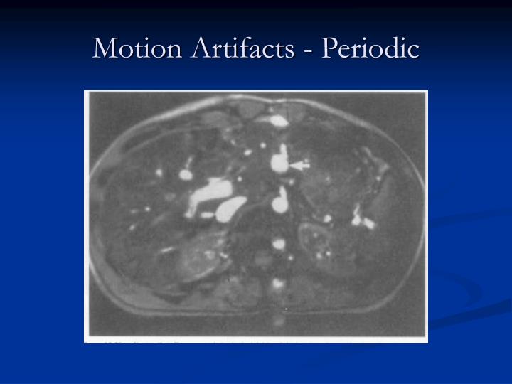 PPT - Basic MRI PowerPoint Presentation - ID:394624