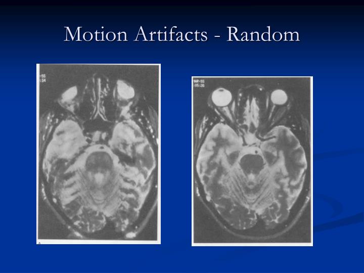 PPT - Basic MRI PowerPoint Presentation - ID:394624