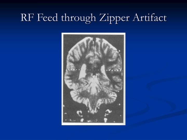 PPT - Basic MRI PowerPoint Presentation - ID:394624