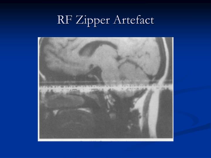 PPT - Basic MRI PowerPoint Presentation - ID:394624