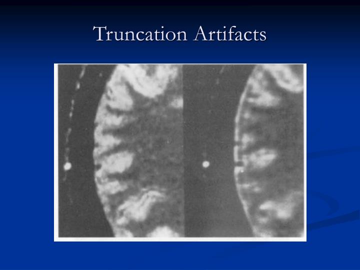 PPT - Basic MRI PowerPoint Presentation - ID:394624