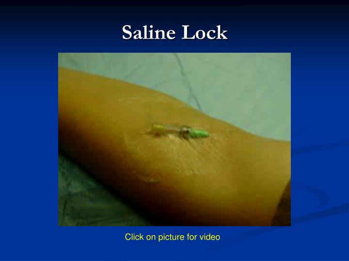 PPT - Initiating a Saline Lock and IV (Ranger Lock) PowerPoint ...