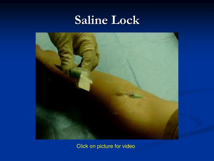 PPT - Initiating a Saline Lock and IV (Ranger Lock) PowerPoint ...