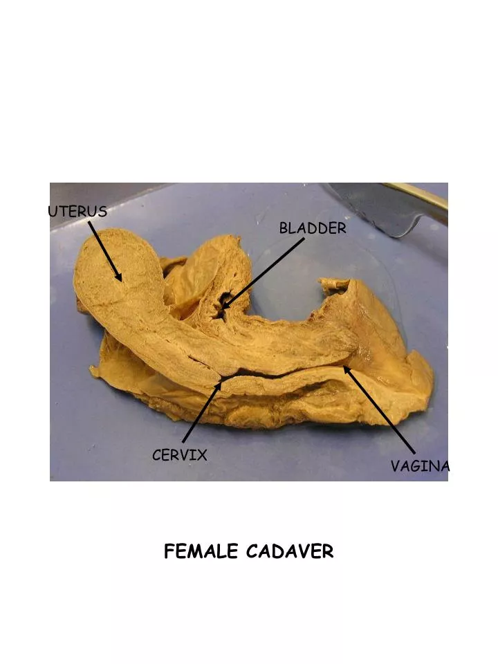 PPT - UTERUS PowerPoint Presentation, free download - ID:399243