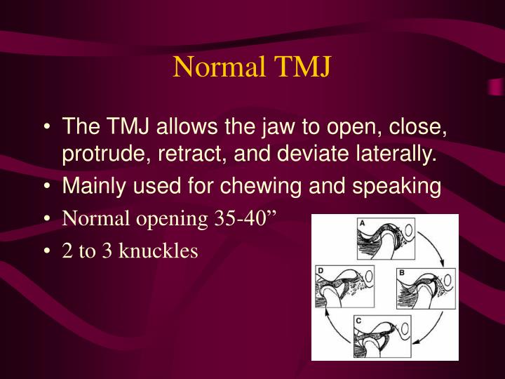PPT - Temporomandibular Disorders and Physical Therapy Interventions ...