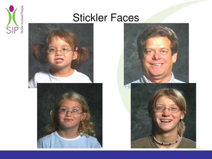 PPT - Stickler Syndrome: A Physician’s Overview PowerPoint Presentation ...