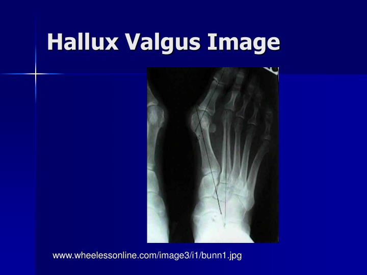 PPT - Diagnostic Radiology III Definitions PowerPoint Presentation - ID ...