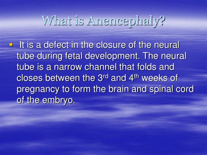 PPT - Anencephaly PowerPoint Presentation - ID:412188