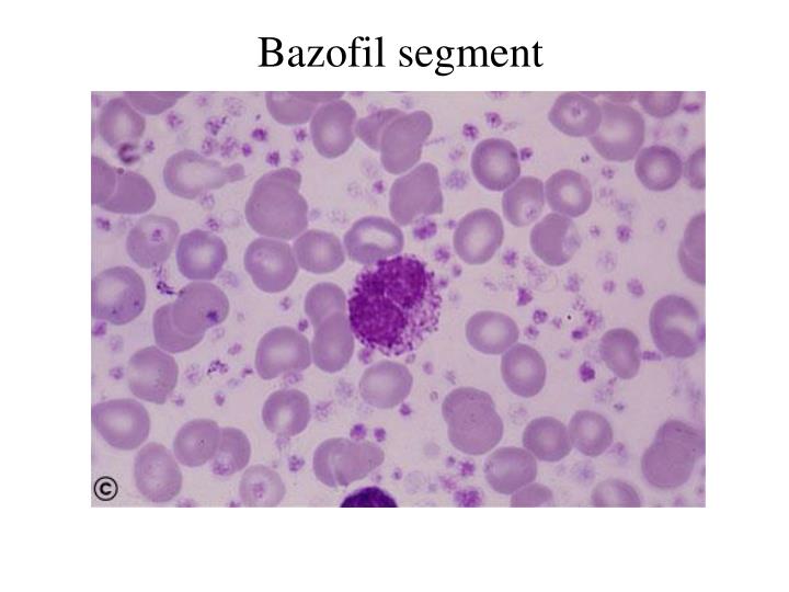 PPT - KEMİK İLİĞİ ve PERİFERİK YAYMA ÖRNEKLERİ PowerPoint Presentation ...