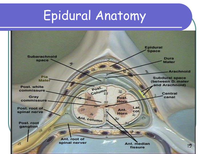 PPT - Post Operative Pain Management: Epidurals Beyond the Operating ...