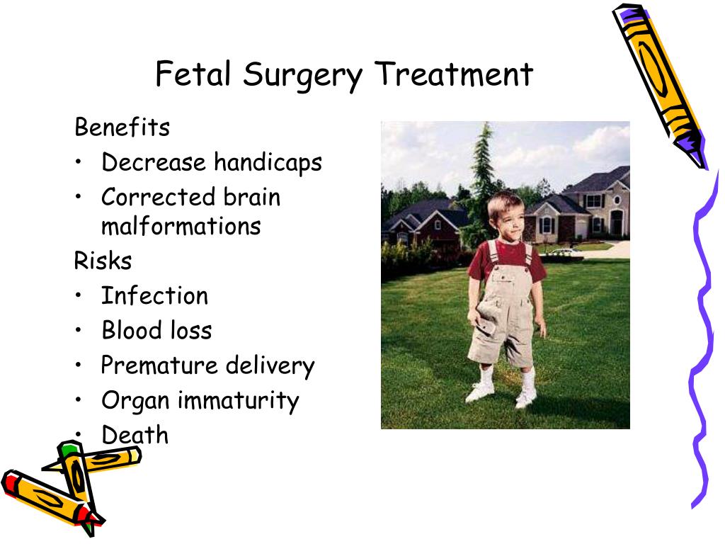 Ppt Spina Bifida Powerpoint Presentation Free Download Id 415438