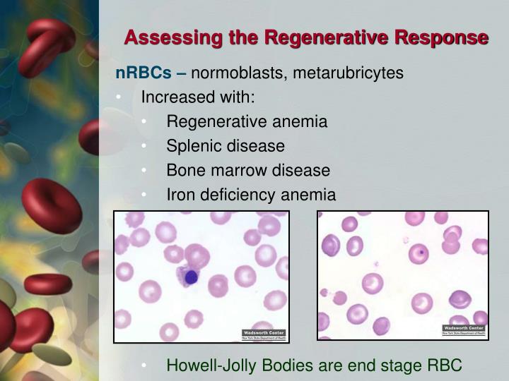 PPT - Practical Hematology Blood Loss Anemia PowerPoint Presentation ...