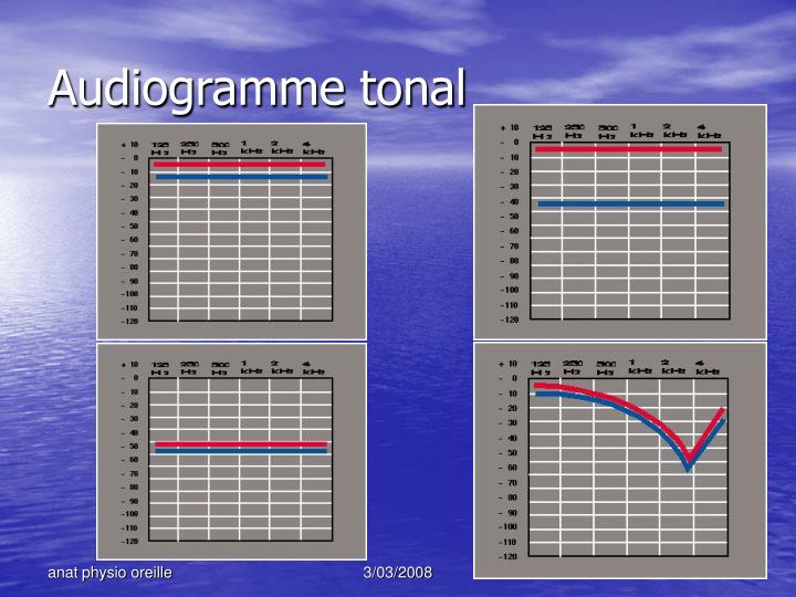 PPT - Anatomie et physiologie de l’oreille PowerPoint Presentation - ID ...