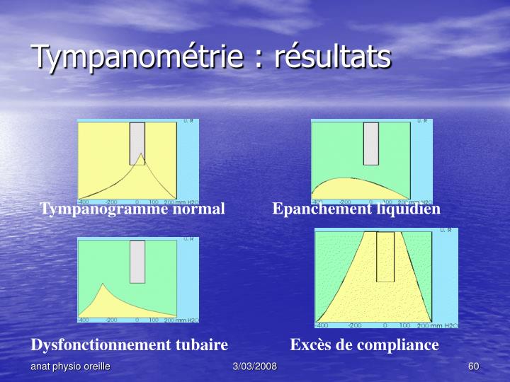 PPT - Anatomie et physiologie de l’oreille PowerPoint Presentation - ID ...