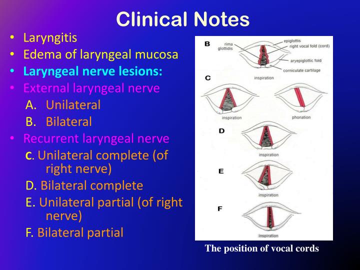 PPT - The Larynx PowerPoint Presentation - ID:417368