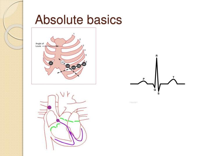 PPT - ECG interpretation for beginners - 1 PowerPoint Presentation - ID ...