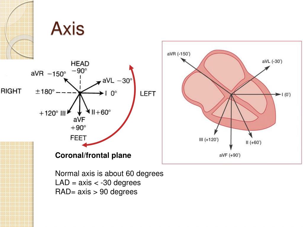 PPT ECG Interpretation For Beginners 1 PowerPoint Presentation