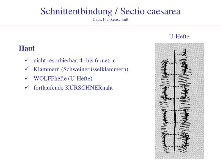 PPT - Schnittentbindung Sectio caesarea PowerPoint Presentation - ID:418552