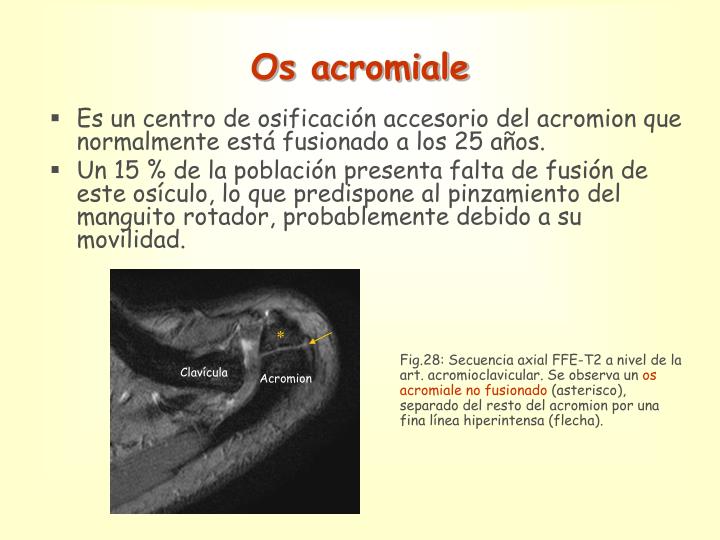 PPT - RM DEL HOMBRO: MÁS ALLÁ DEL MANGUITO DE LOS ROTADORES PowerPoint ...