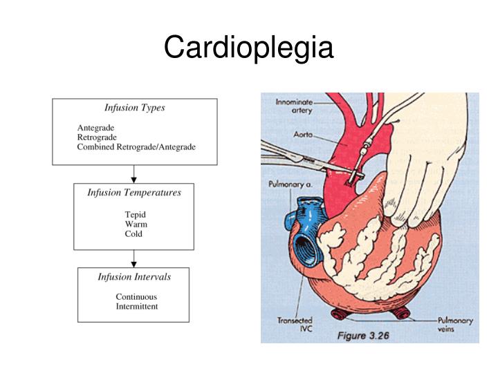 PPT - CABG Anatomy On off pump Conduits PowerPoint Presentation - ID:421370