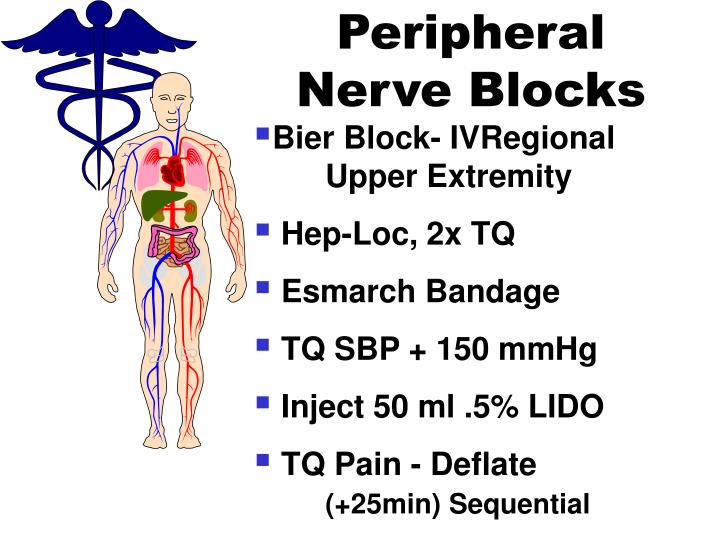 PPT - Regional Anesthesia for Anesthesiology Nursing Peripheral Nerve ...