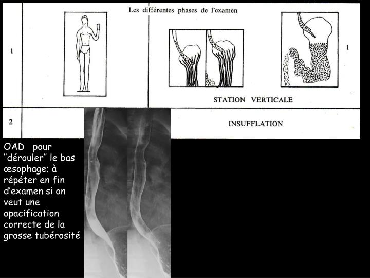 PPT - TOGD PowerPoint Presentation - ID:423799