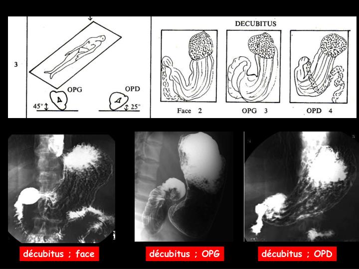 PPT - TOGD PowerPoint Presentation - ID:423799