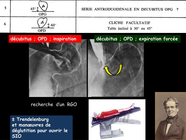 PPT - TOGD PowerPoint Presentation - ID:423799