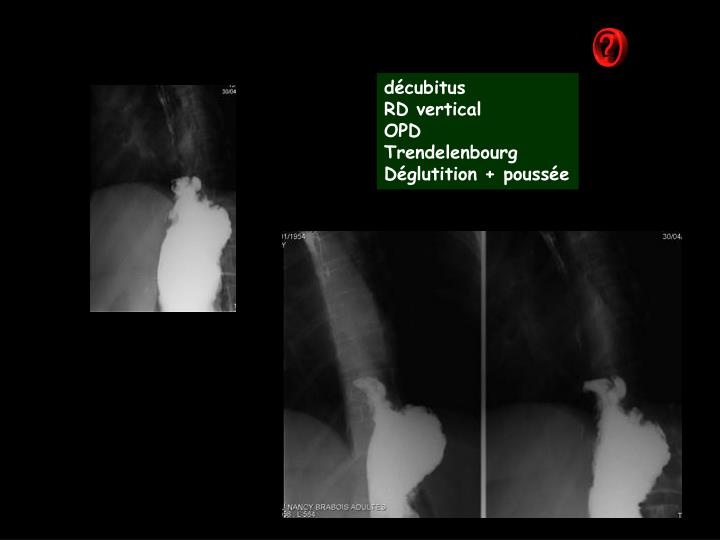 PPT - TOGD PowerPoint Presentation - ID:423799