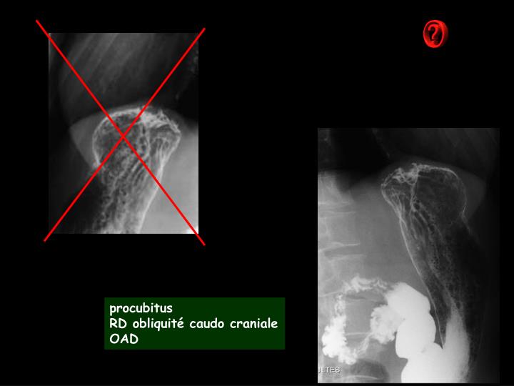 PPT - TOGD PowerPoint Presentation - ID:423799