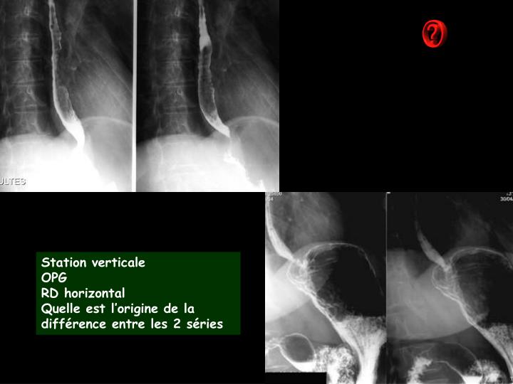 PPT - TOGD PowerPoint Presentation - ID:423799