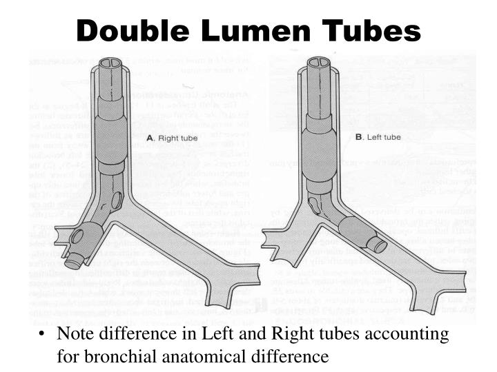PPT - Thoracic Anatomy & Physiology A Simple Review PowerPoint Presentation - ID:425037