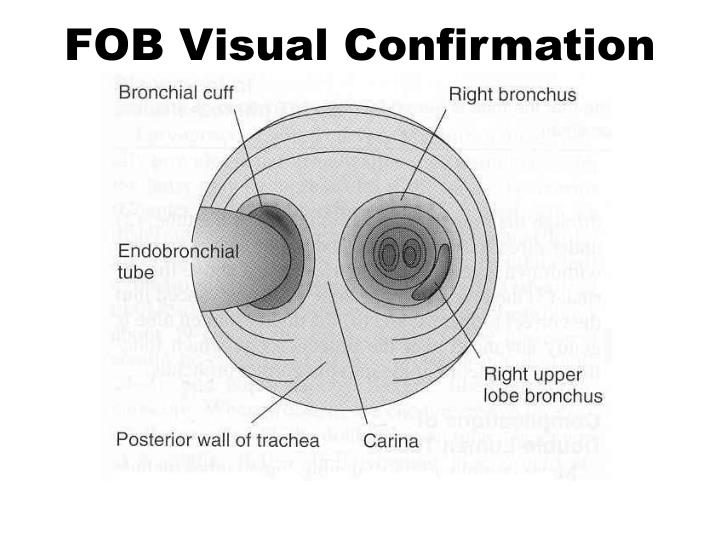 PPT - Thoracic Anatomy & Physiology A Simple Review PowerPoint ...