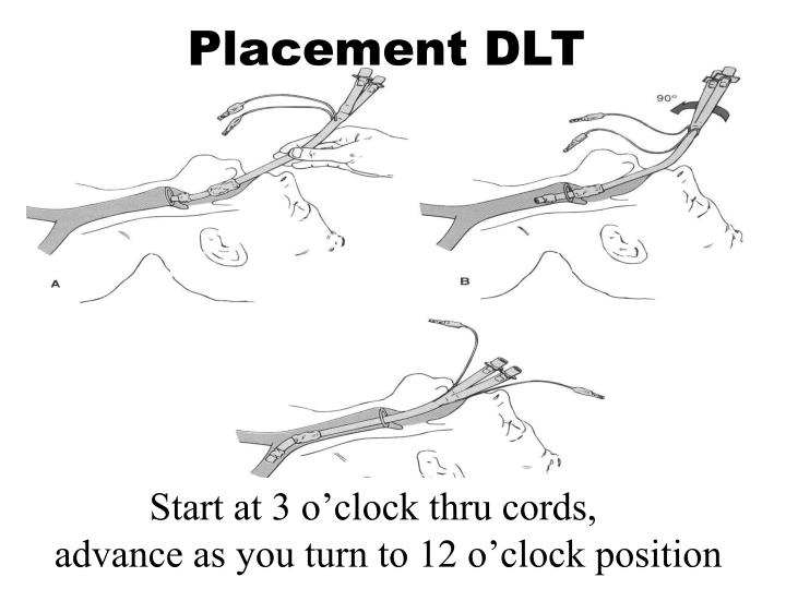 PPT - Thoracic Anatomy & Physiology A Simple Review PowerPoint ...
