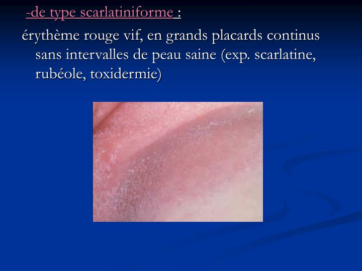 PPT - Les lésions élémentaires en dermatologie PowerPoint Presentation ...