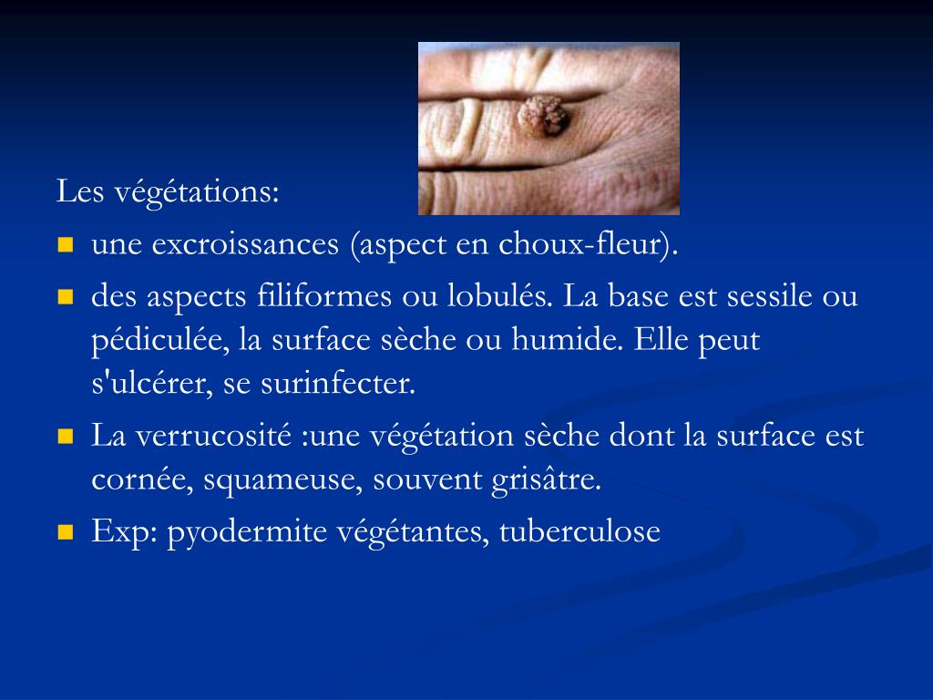 PPT - Les lésions élémentaires en dermatologie PowerPoint Presentation ...